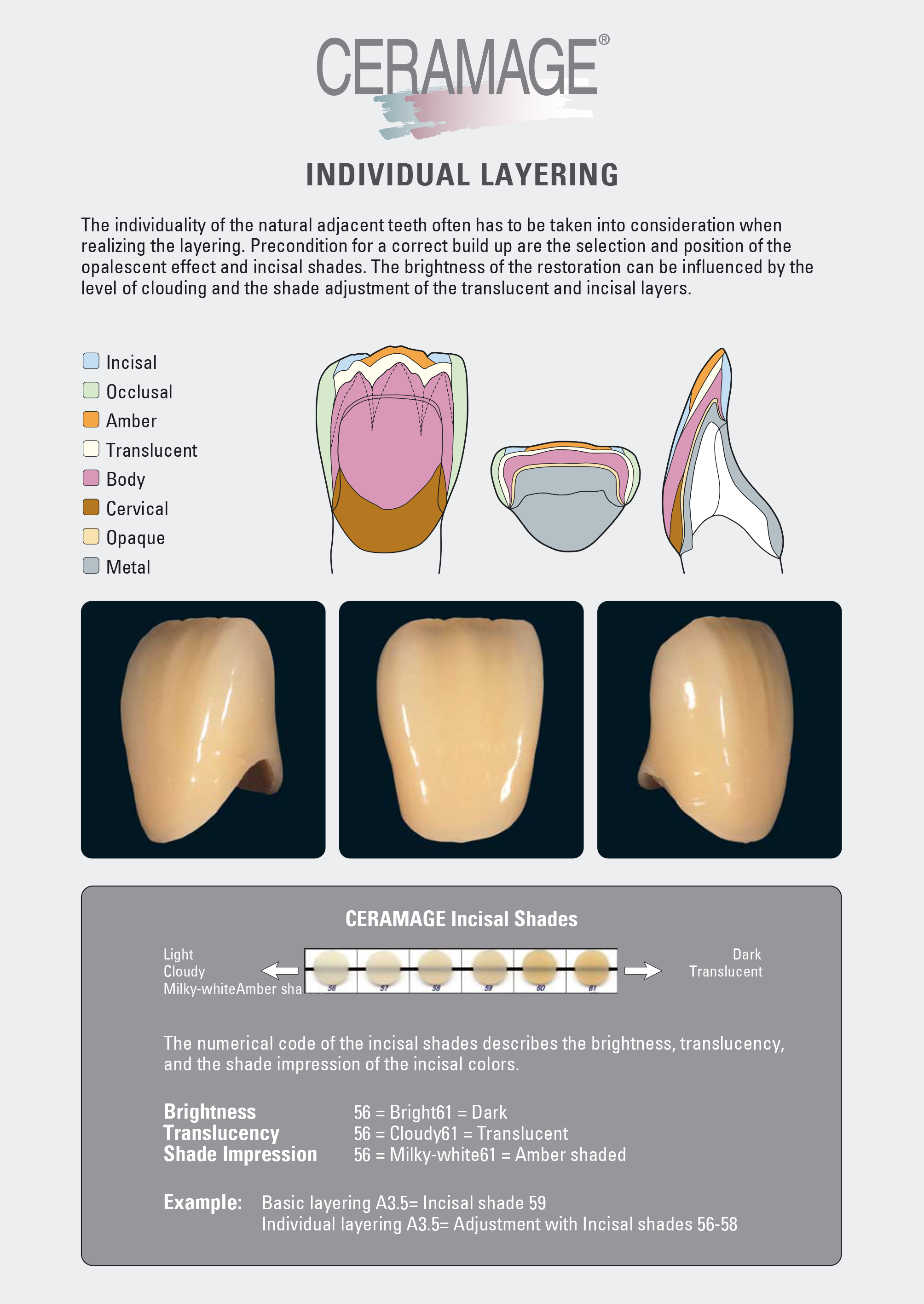 کامپوزیت های لابراتواری ceramage شوفو - شرکت آوا طب برنا